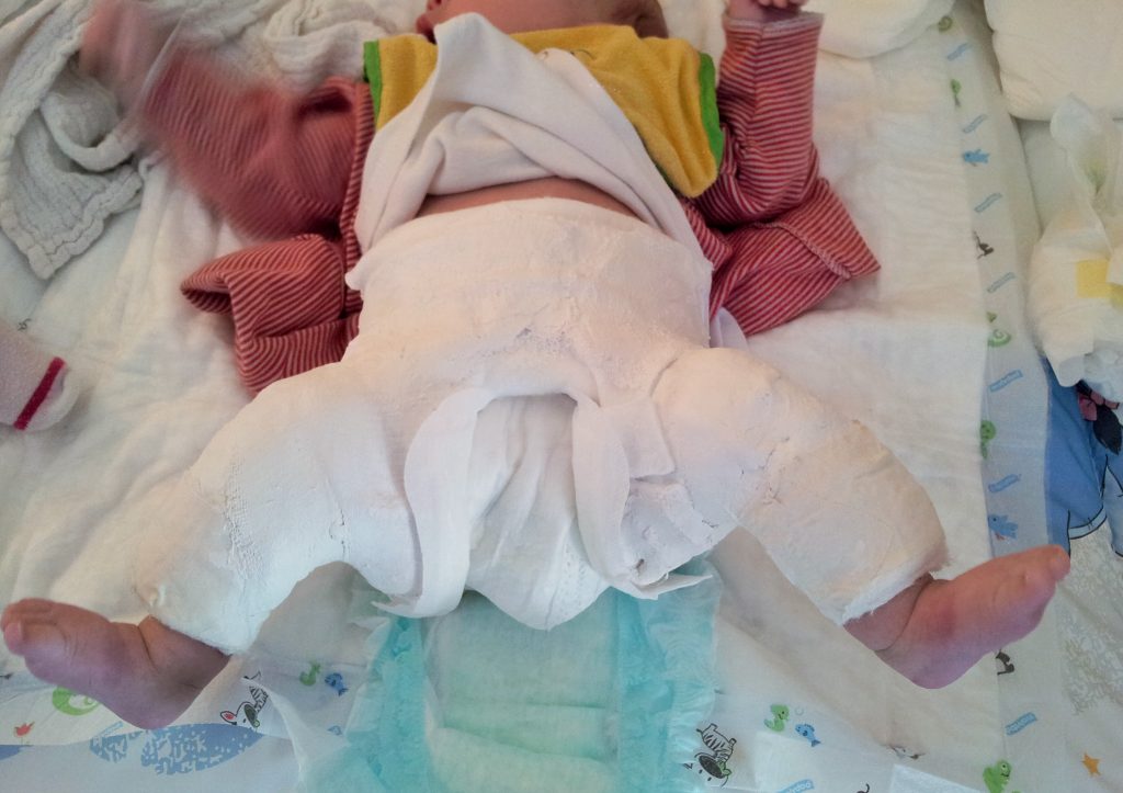 Hüftdysplasie / Hüftluxation Archive - von knall bis bunt