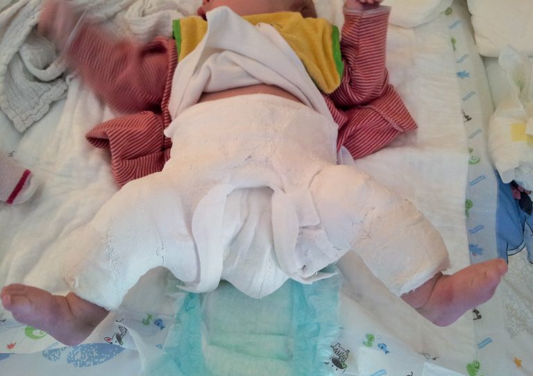 Hüftdysplasie / Hüftluxation Archive - von knall bis bunt